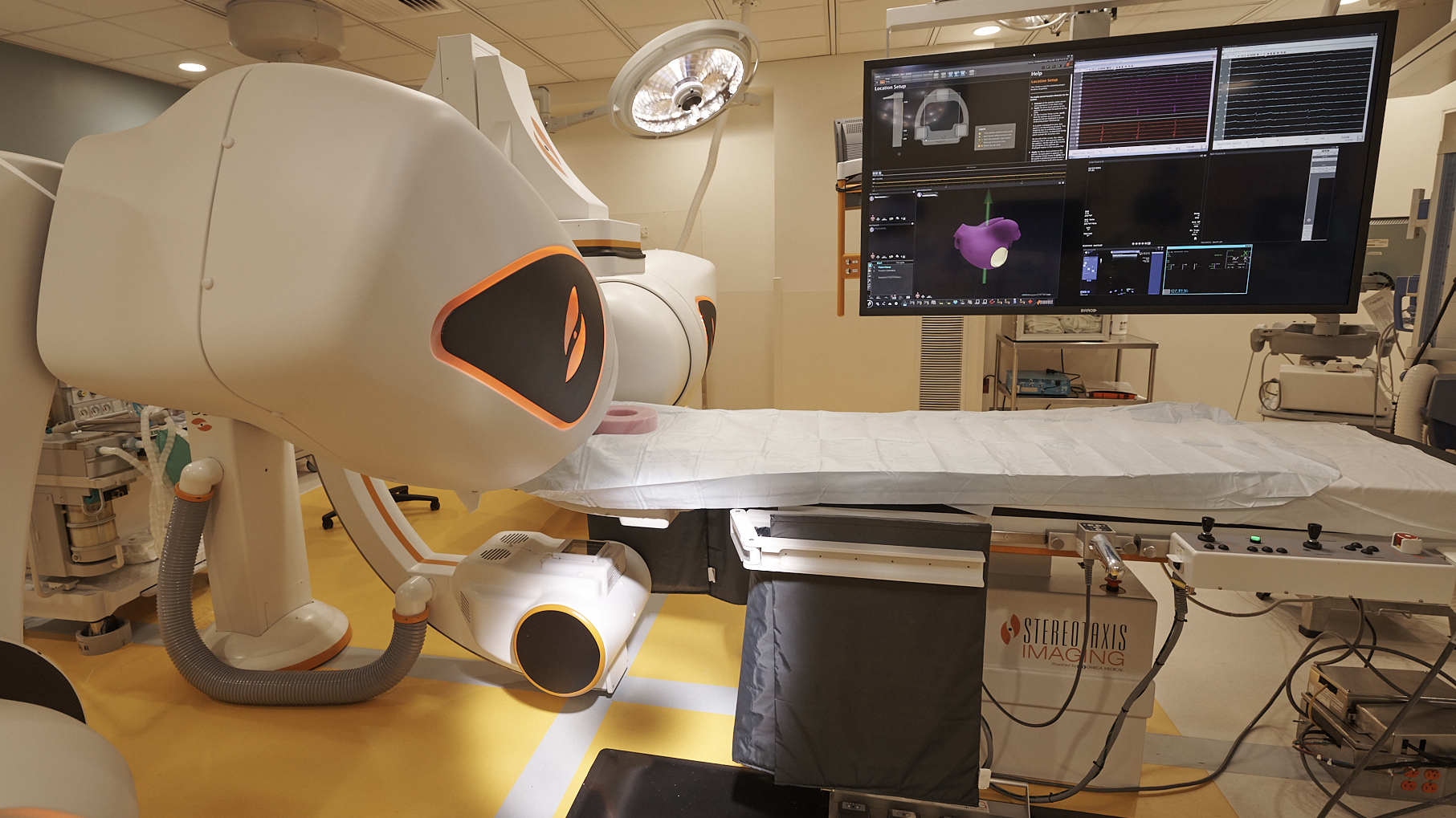 New Technology for Treating Cardiac Arrhythmias